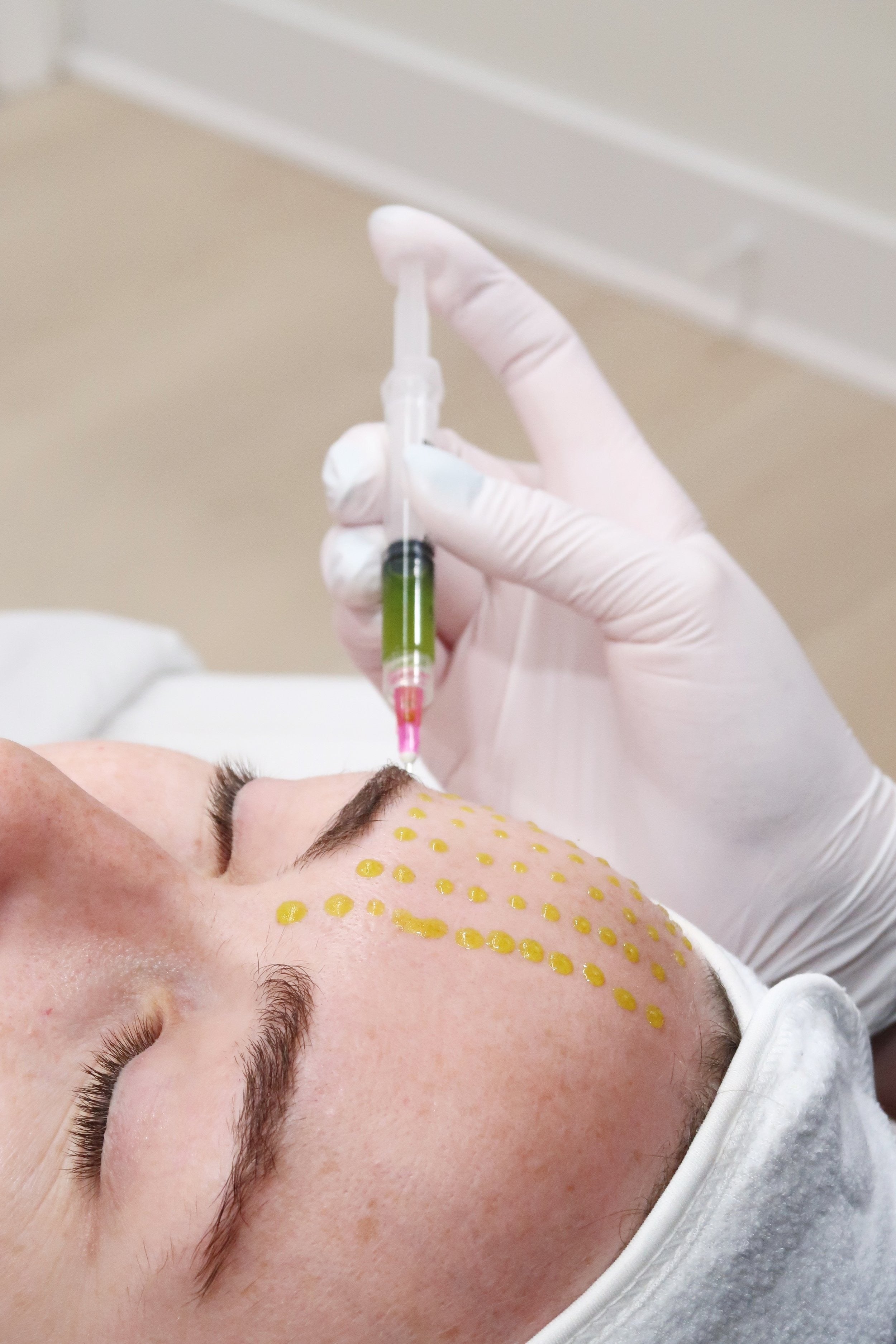 FALL CALLS FOR PEELS – SKINriched